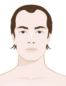 Håravfall hos män – höga tinningar & tunt hår: Så avhjälps det